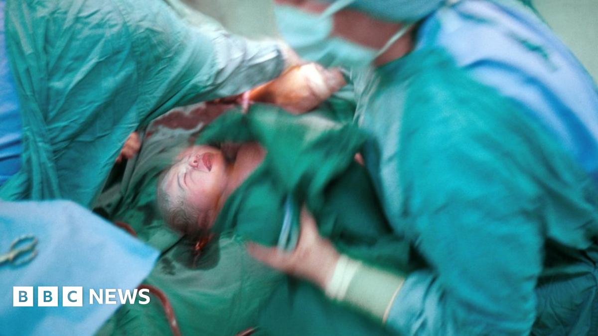 C-section rates 'vary widely' across Europe - BBC News