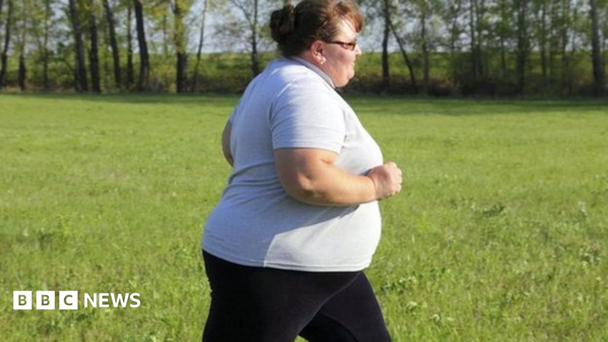 NHS approach to obesity inexplicable, say MPs - BBC News
