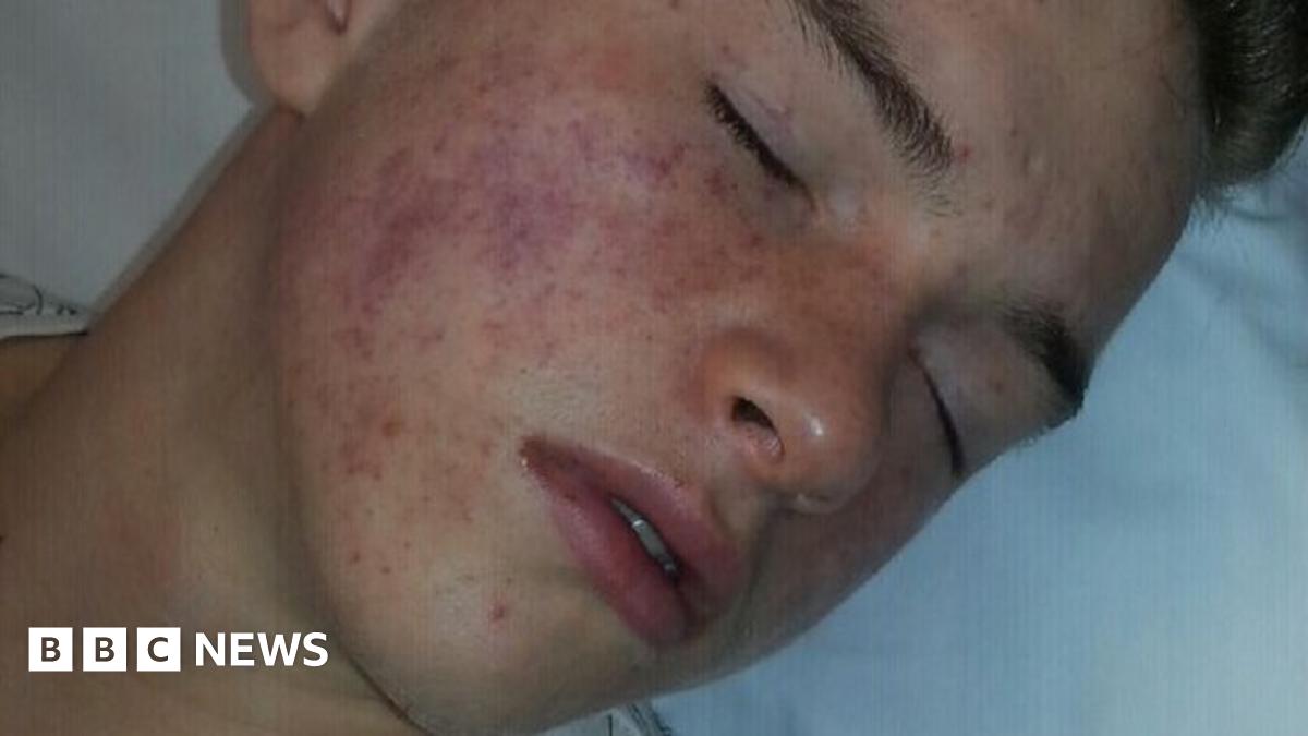 'Legal high' boy says, 'I thought I was going to die' - BBC News