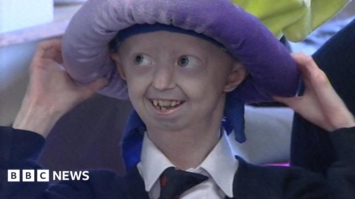 Hayley Okines: Bexhill funeral for progeria campaigner - BBC News