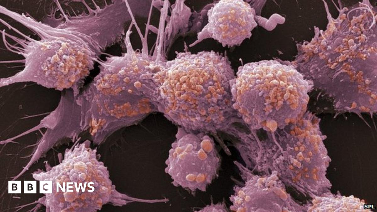 Prostate cancer gene map points way to targeted drugs - BBC News