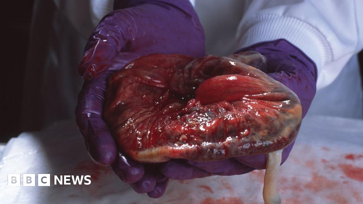 Eating placenta 'does not benefit health' - BBC News