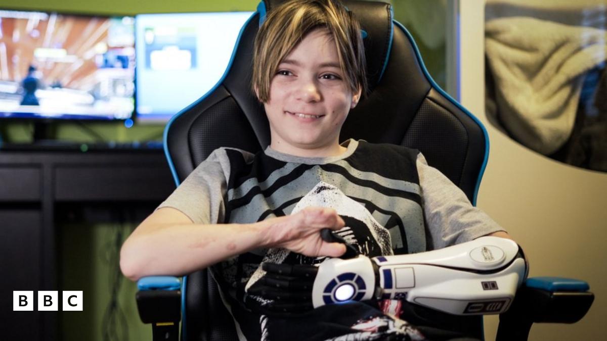Star Wars: 11-year-old fan gets special R2D2 bionic arm - BBC Newsround