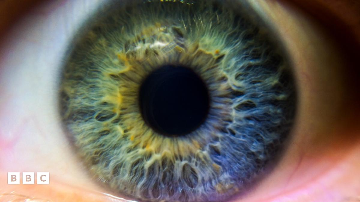 World's first complete eye transplant takes place in US - BBC Newsround