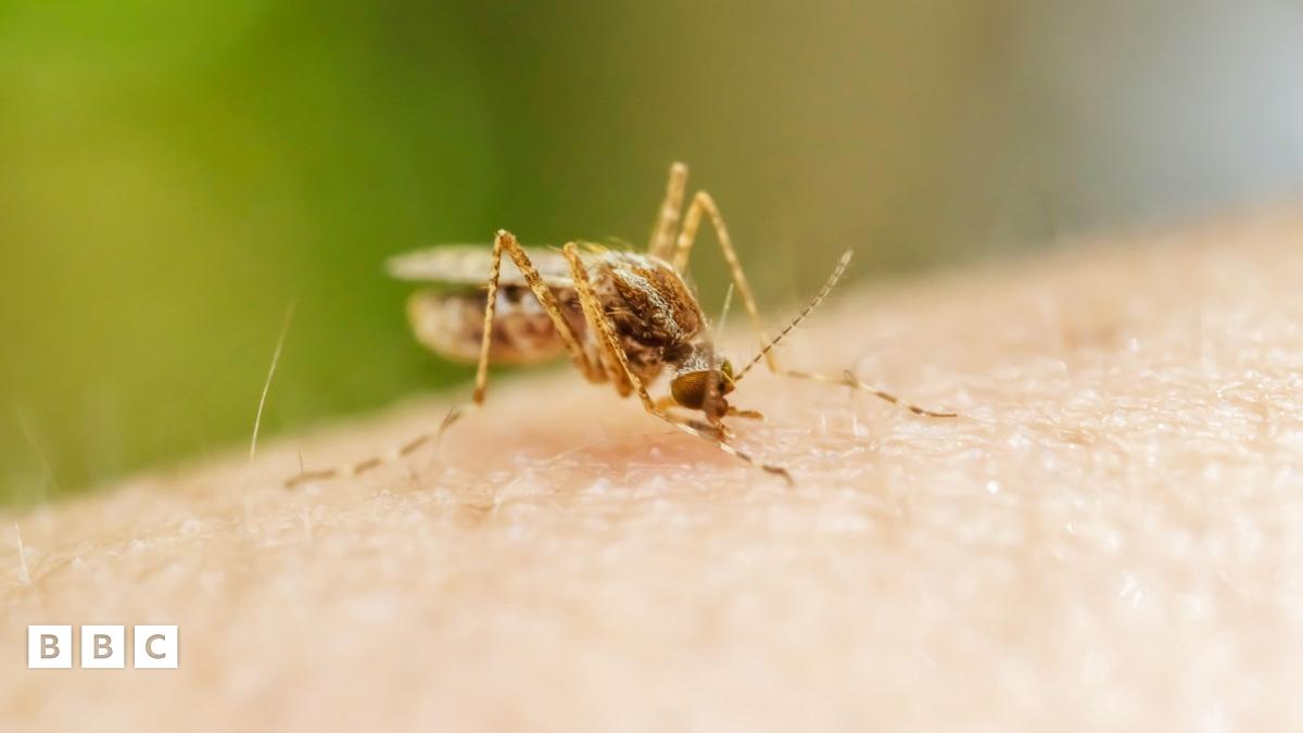 Clarisse_leroi mym to begin with I want to say I underwent