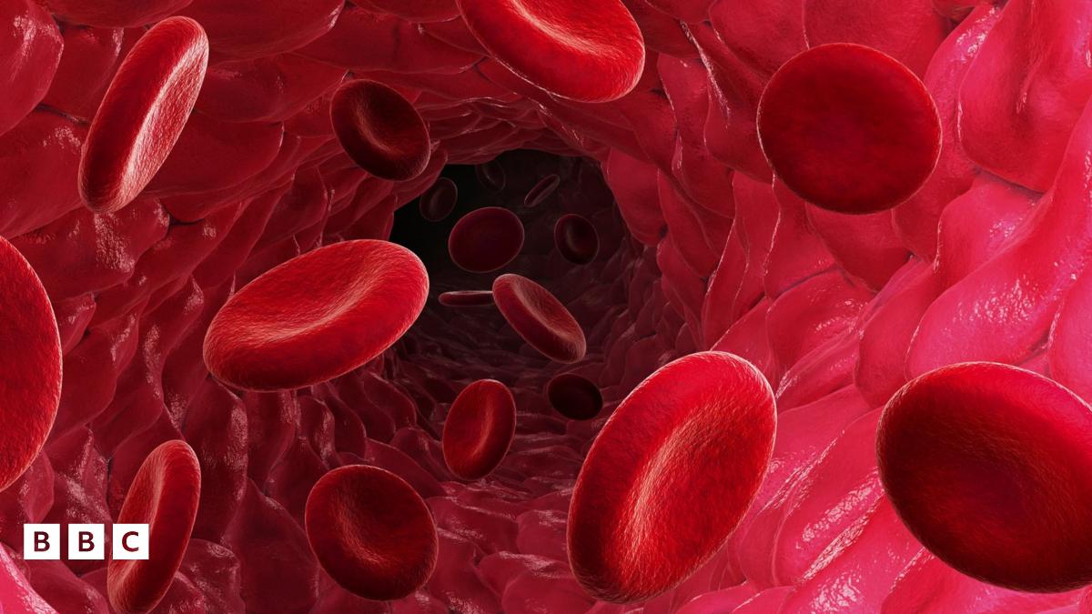 Girl gets new vein transplant - BBC Newsround