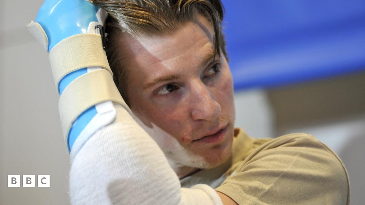 US Soldier has double arm transplant - BBC Newsround