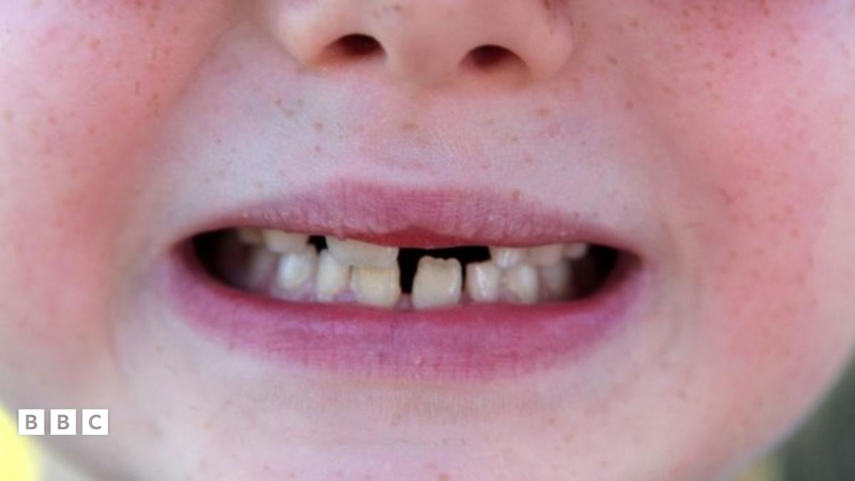 Humans could evolve to grow beaks instead of teeth - BBC Newsround