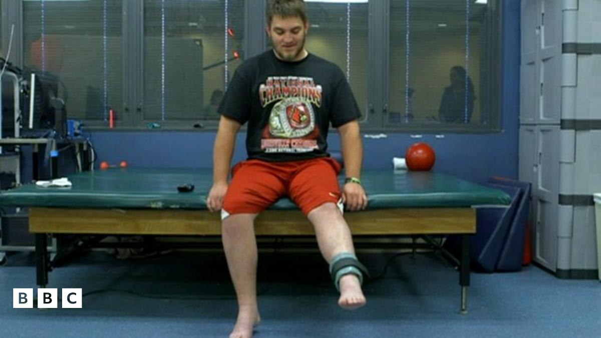 How electrical pulses help paralysed men move legs - BBC Newsround