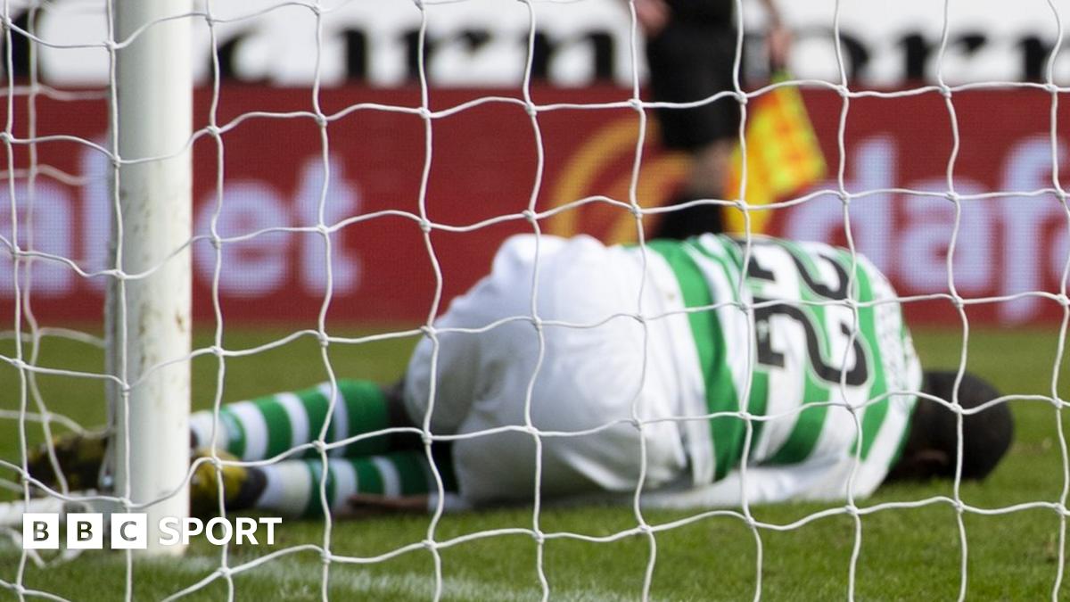 Celtic can cope with "stretched" injury list, "no problem" - says Chris ...