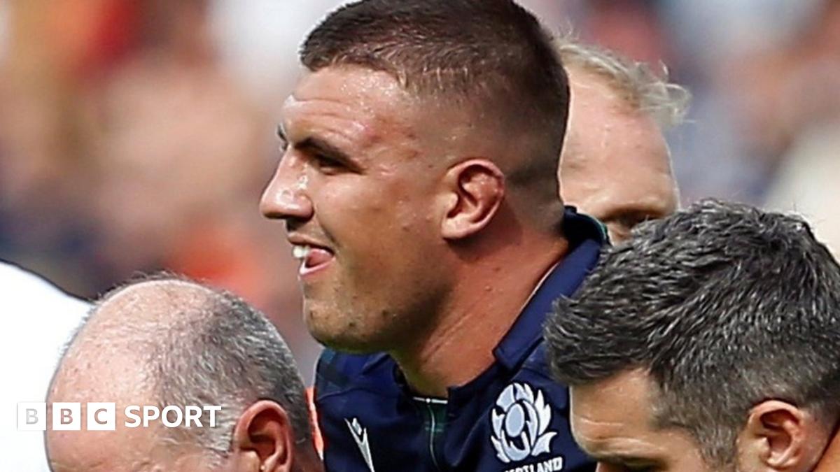 Sam Skinner: Scotland lock still has Six Nations hopes as he continues ...