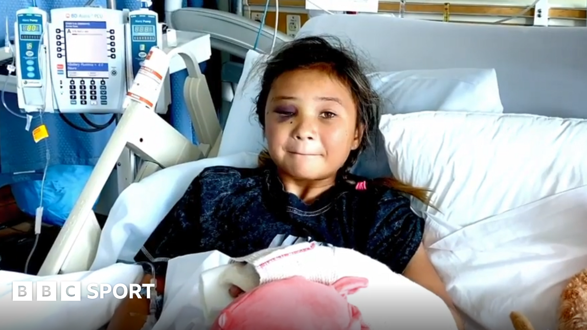 Sky Brown: Skateboarder, 11, 'lucky to be alive' after horrific fall ...