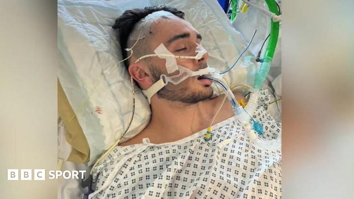 Alex Fletcher: Bath City striker on impact of life-threatening skull ...
