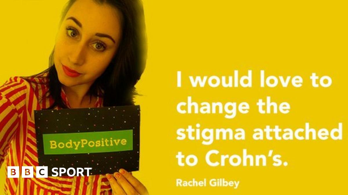 Rachel's Story: Me and Crohn's disease - BBC Sport