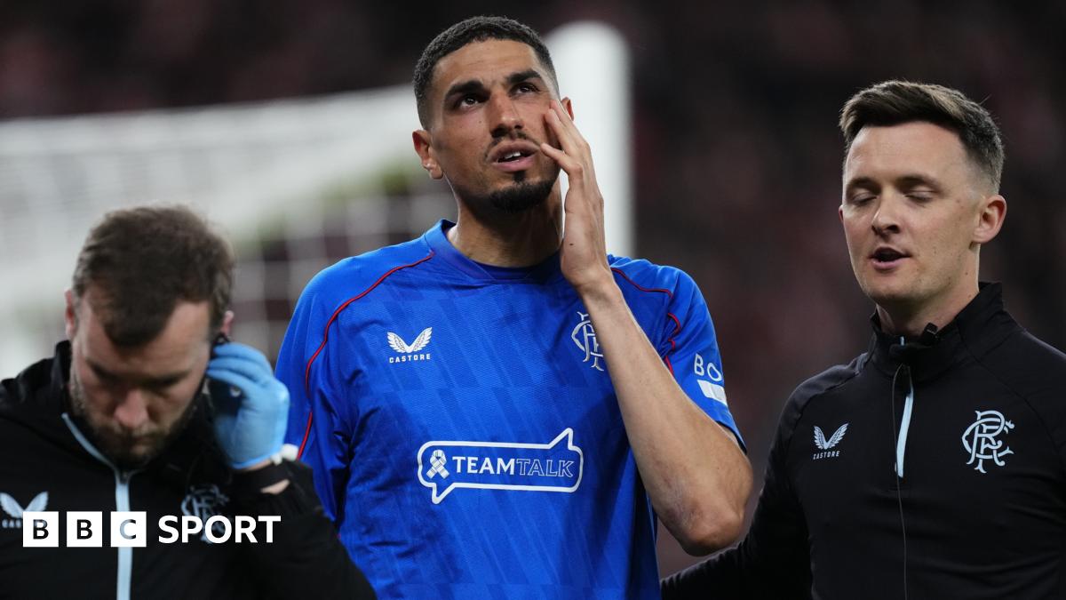 Balogun fractures cheekbone but hopes season not over - BBC Sport