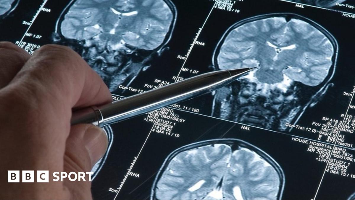 Sports-related brain injury: New research finds links between ...