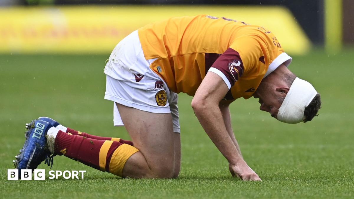 Concussion substitutes: SPFL asks all 42 clubs if they back ...