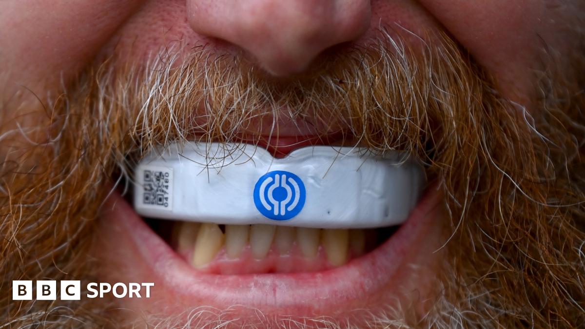 Smart gumshields: Why were they introduced, and what more can be done ...