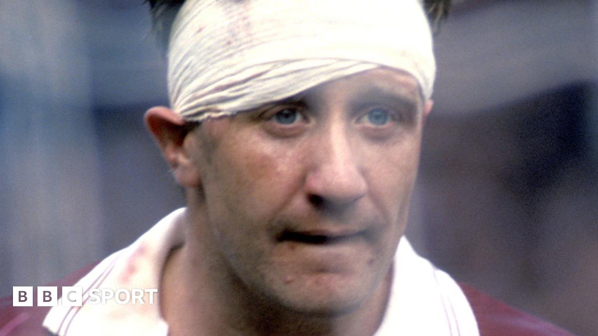 John Robertson: Scottish FA & PFA should have brain damage testing ...