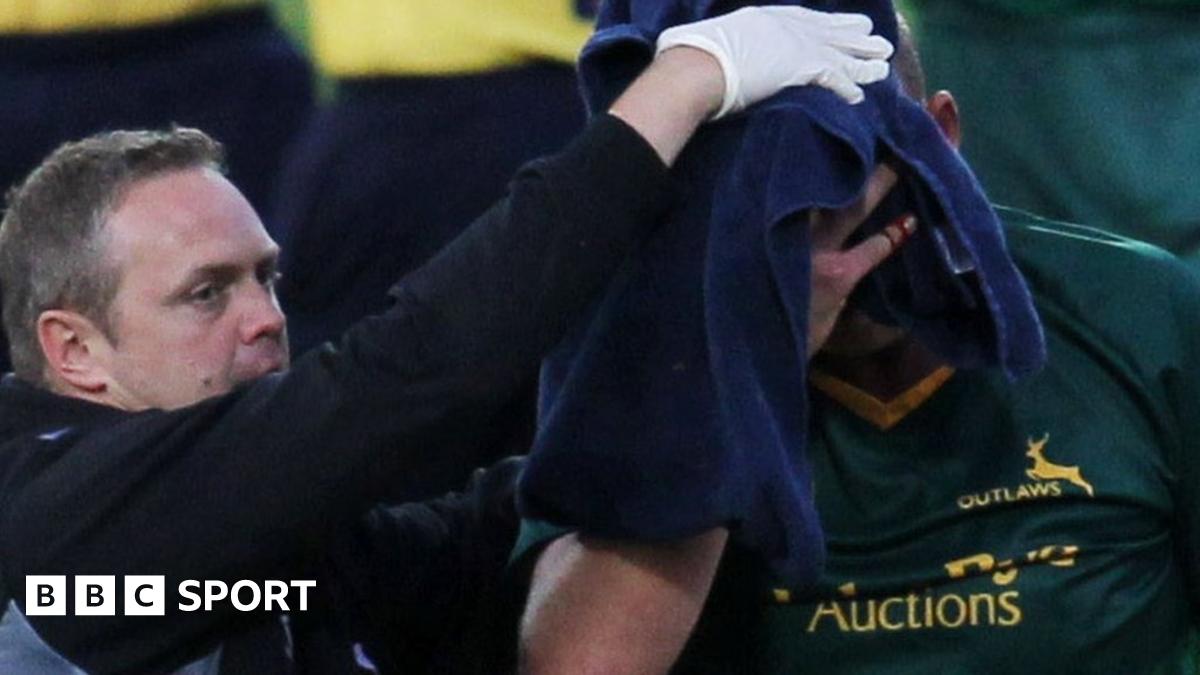 Luke Fletcher: Bowler hit by ball 'lucky' to escape serious injury ...