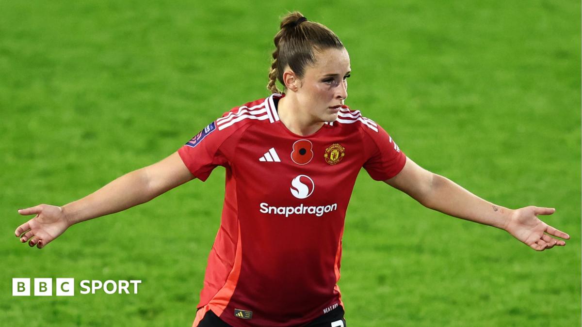 Ella Toone: England midfielder sustains calf injury in Manchester ...