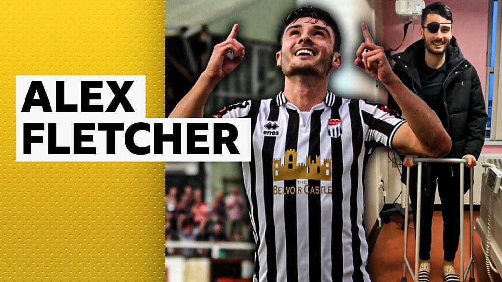 Alex Fletcher: Bath City striker on life-threatening skull injury which ...