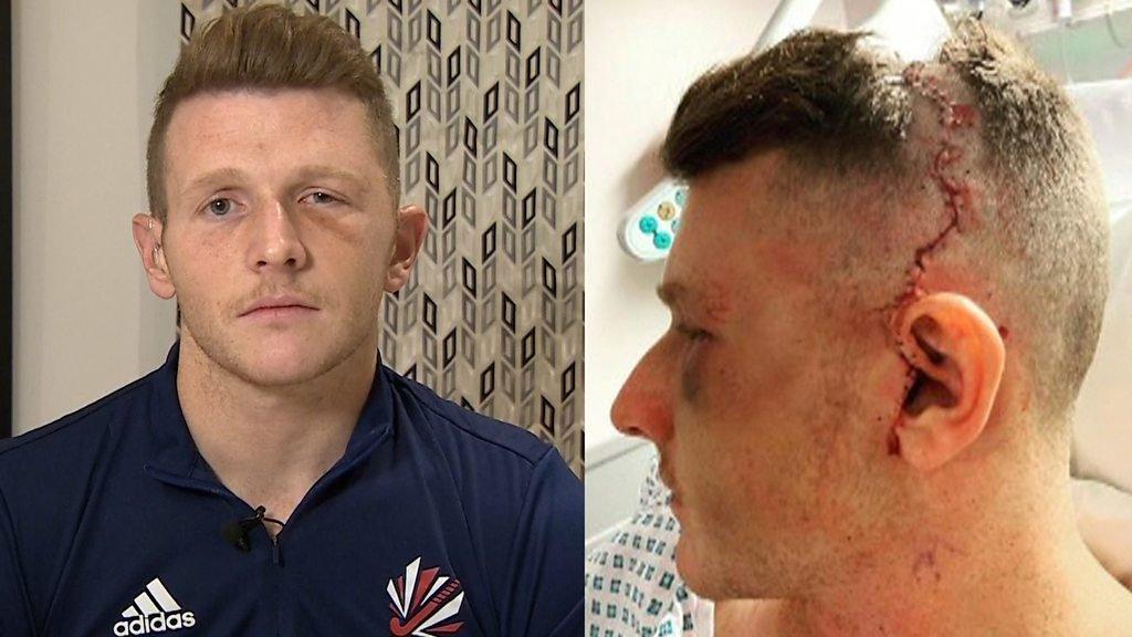 Sam Ward not giving up on Olympic dream despite 'freak' injury - BBC Sport
