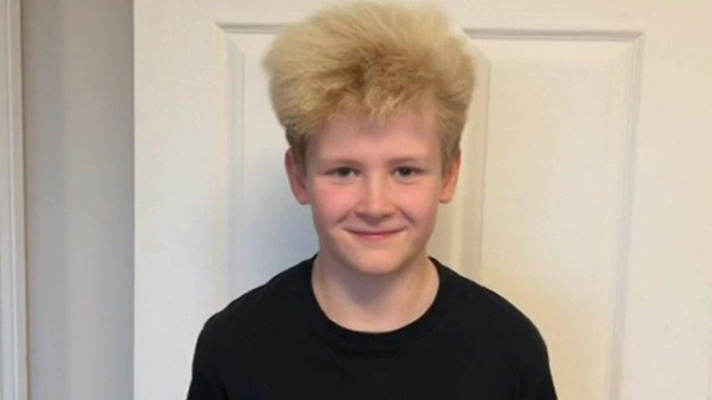 Uncombable hair syndrome: Sam tells his story - BBC Newsround