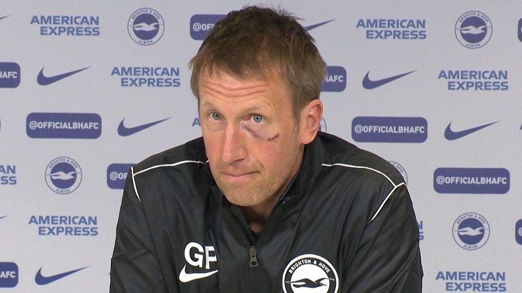 That's quite a shiner, Graham! How Potter was left with gash on his ...