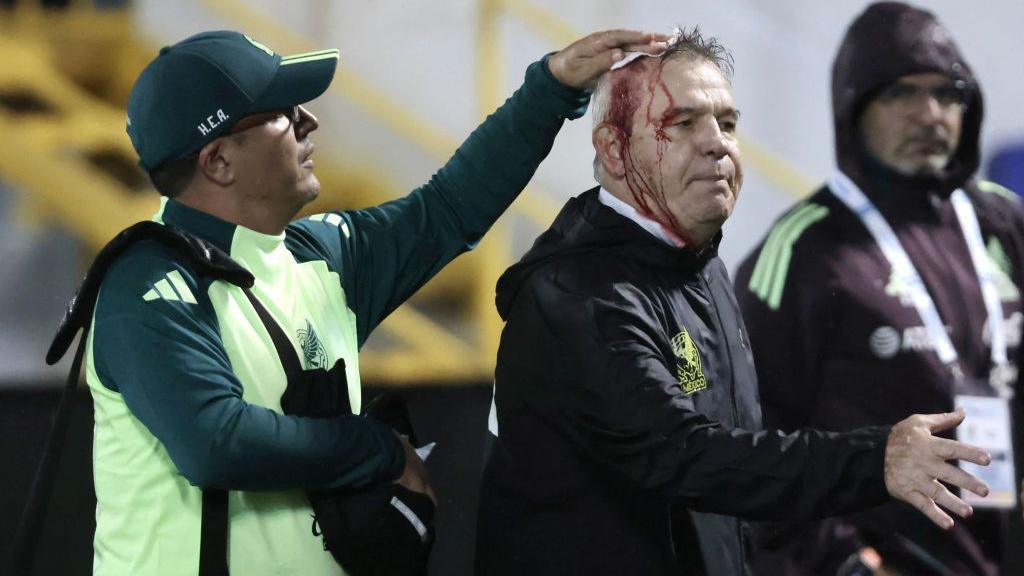 Mexico coach Javier Aguirre left bloodied after being hit with beer can ...