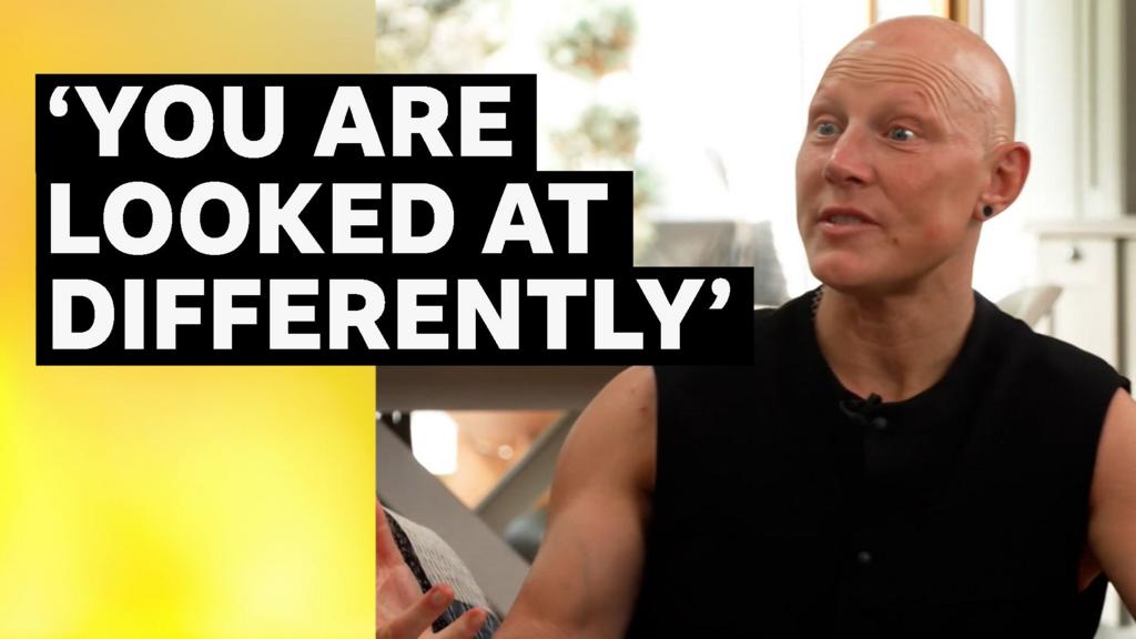 Heather Fisher on alopecia, identity & resilience - BBC Sport