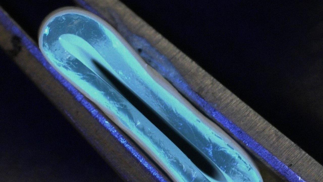 New 3D printed blood vessels could help with heart operations - BBC ...