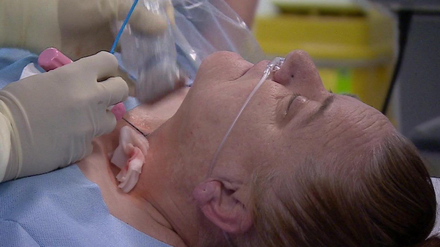 Doctors use microwave solution to thyroid problems - BBC News