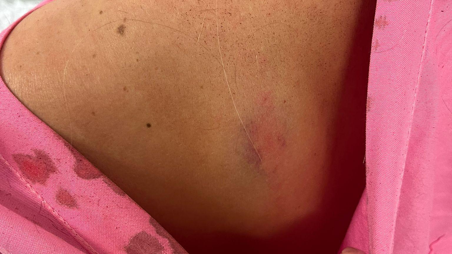 'I am so lucky to be alive after Newton Hospital crowbar rampage' - BBC ...