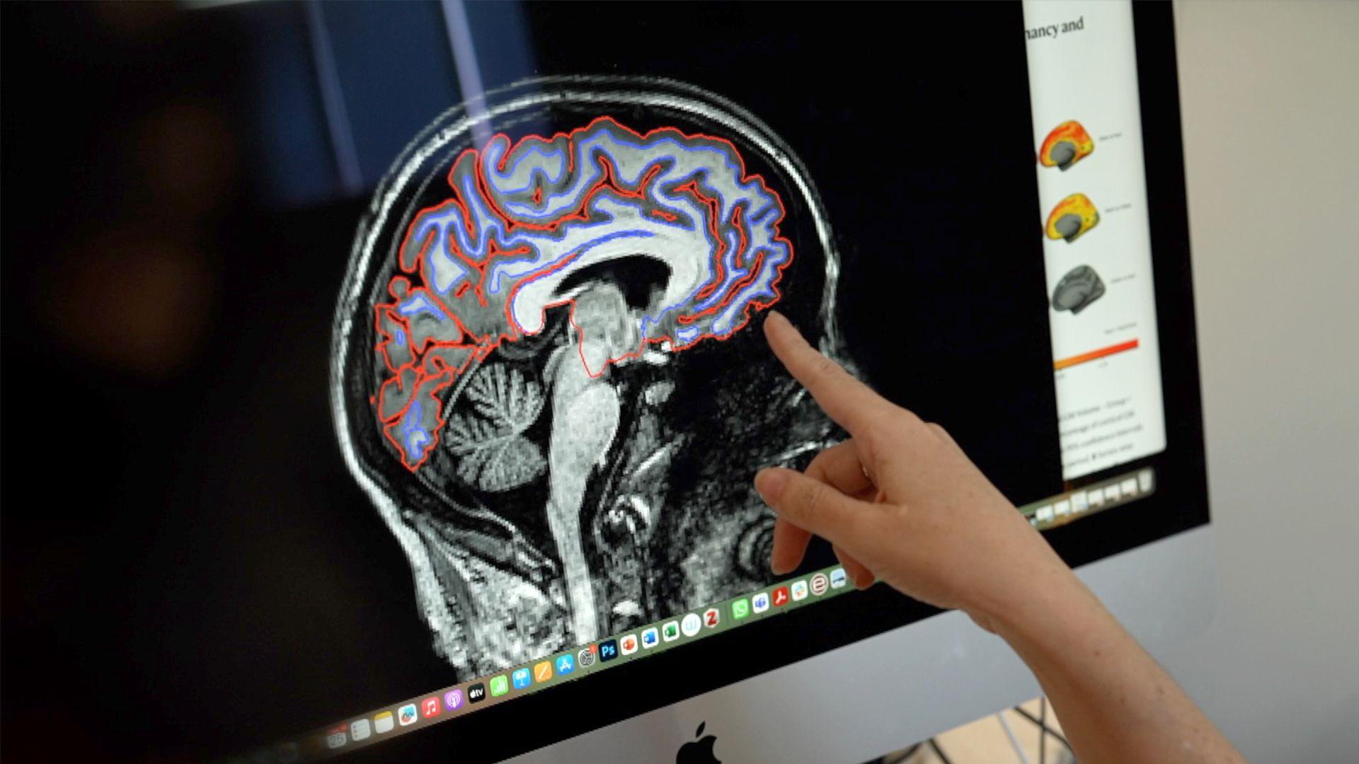 Pregnant women's brains shed grey matter to prime them for motherhood ...