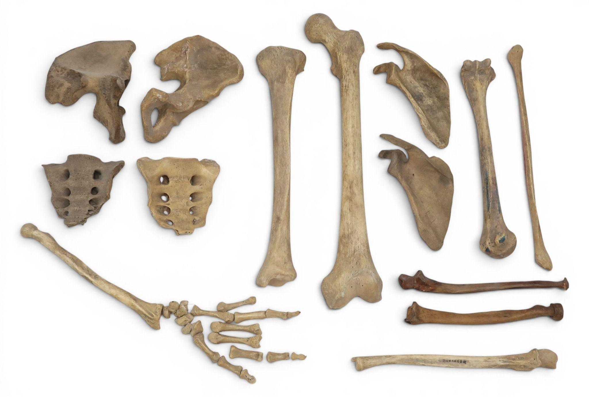 Anita Manning's auction house criticised for offering human remains ...