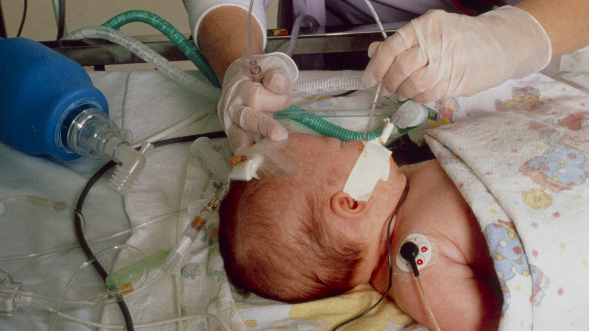 Large decrease in number of births, ONS figures show - BBC News