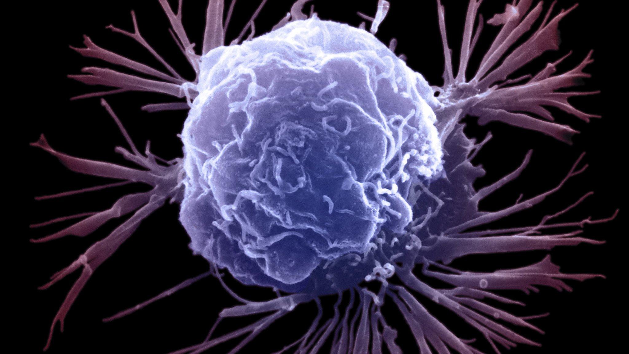 Island's first dedicated breast cancer unit opens - BBC News