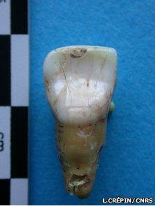 A human incisor (L.Crépin/CNRS)