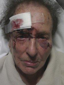 Reward of £10,000 offered to find attackers of Jean Thomas - BBC News