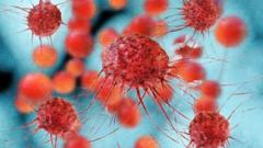 What is chemotherapy? - BBC News