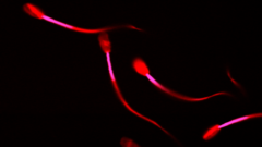 Contraception: Which is most effective? - BBC News