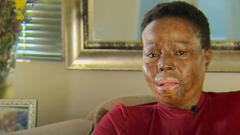 'Dead' woman found alive in South Africa morgue fridge - BBC News