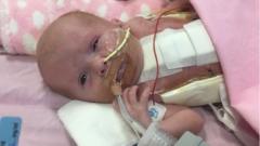 'One-of-a-kind' girl born with heart outside chest has pioneering ...