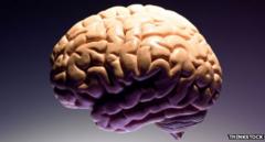 The strange and curious history of lobotomy - BBC News