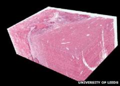 3D images of tissue may help spot and treat cancer - BBC News