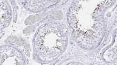 Testes 'most distinct human tissue' - BBC News