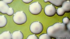 Drug-resistant typhoid 'concerning' - BBC News