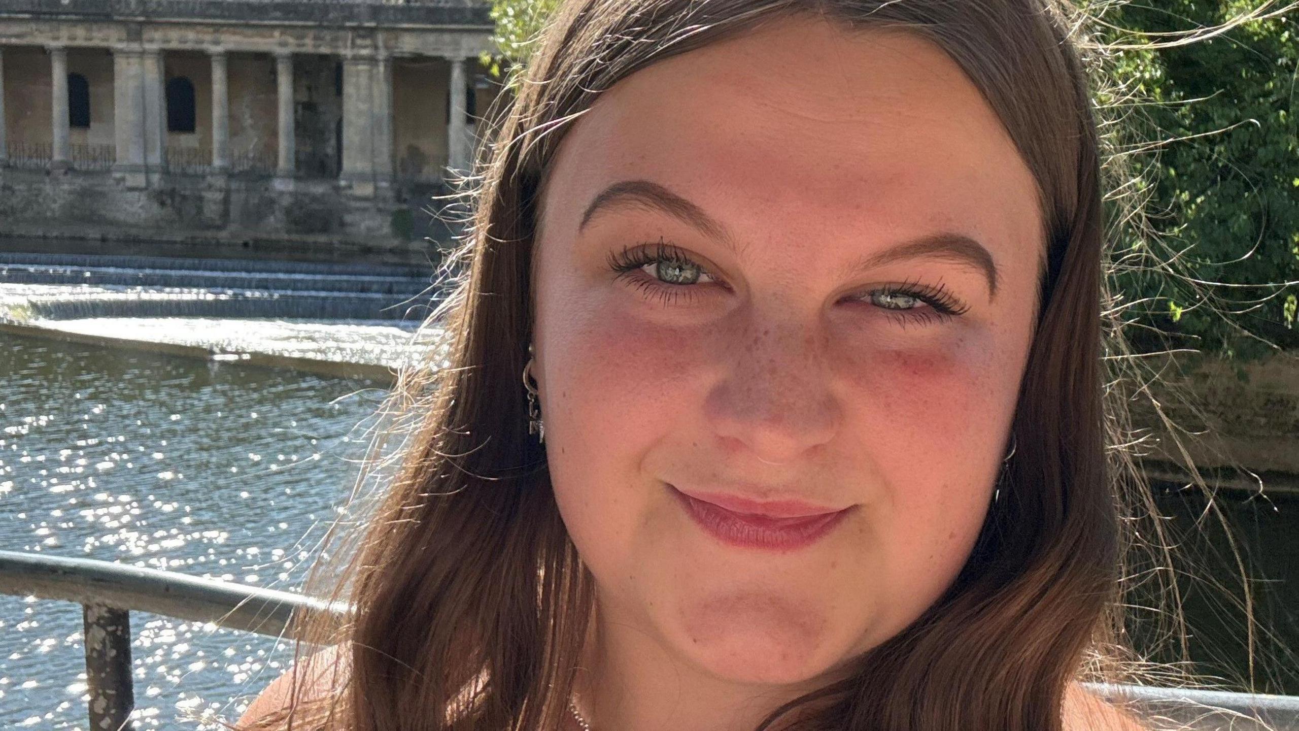 'Lucky to be alive' meningitis survivor shares warning - BBC News