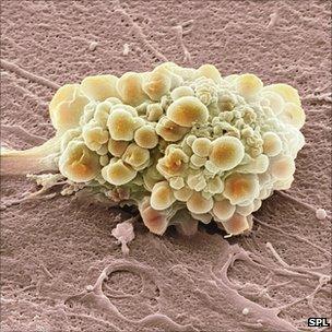 British flowers are the source of a new cancer drug - BBC News